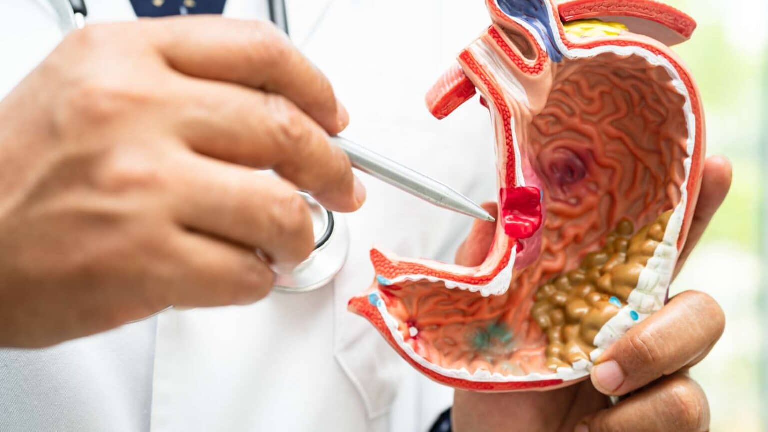 How Long Can You Live With Stomach Cancer | Dr Nivedita