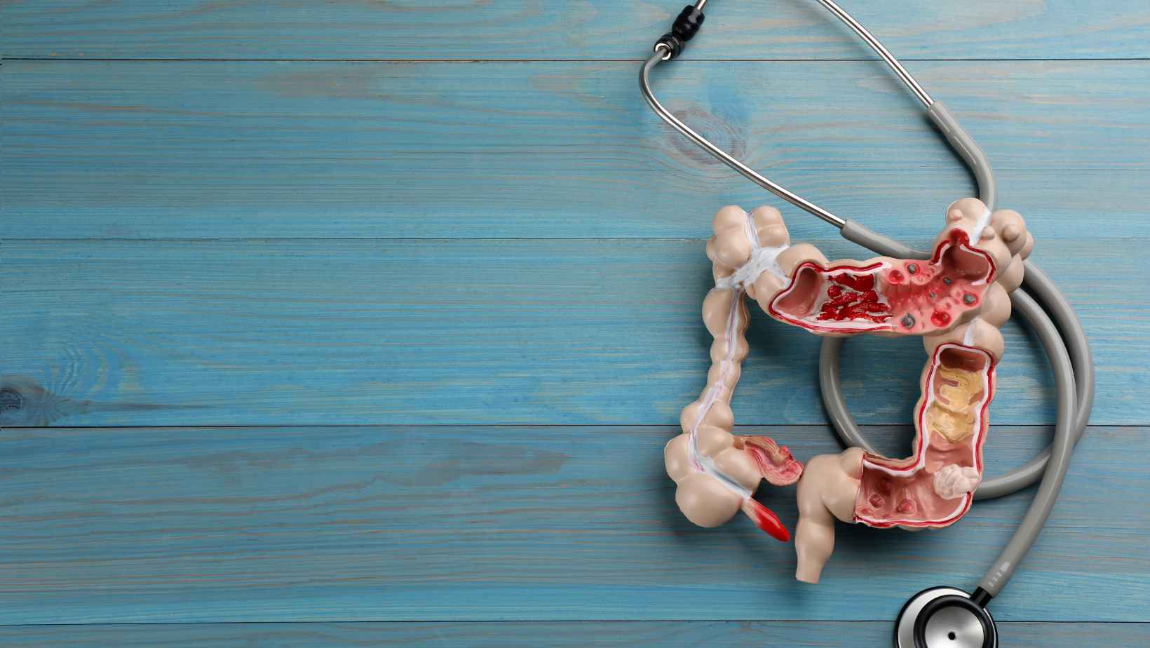 Causes Of Gastrointestinal Bleeding: Understanding The Risk Factors