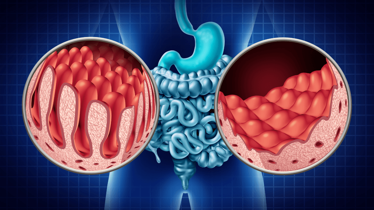 Best Probiotic For Intestinal Health: Enhance Your Gut Flora Naturally