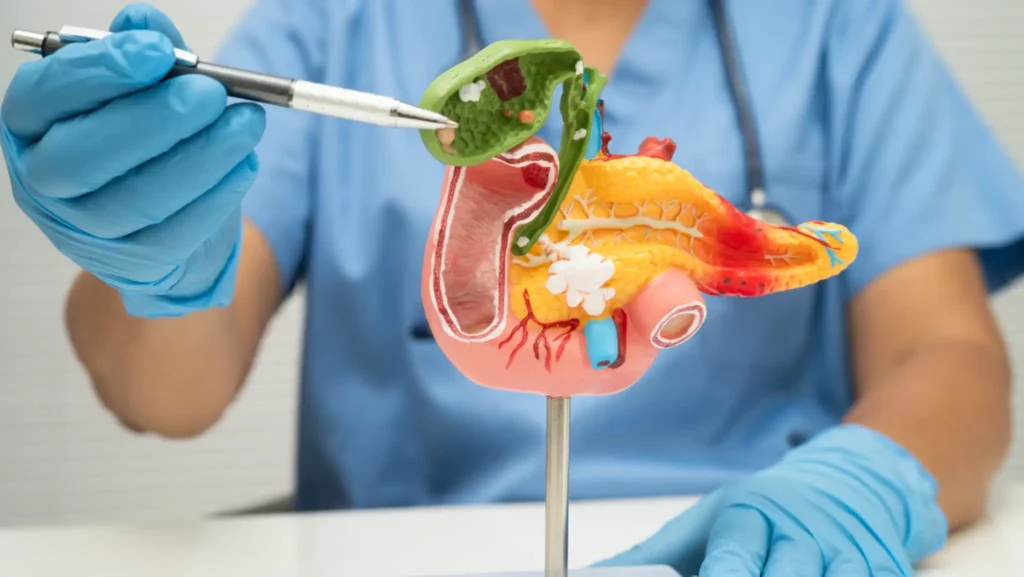 Bile Reflux: Symptoms, Causes, Treatment, And How It Differs From Acid ...
